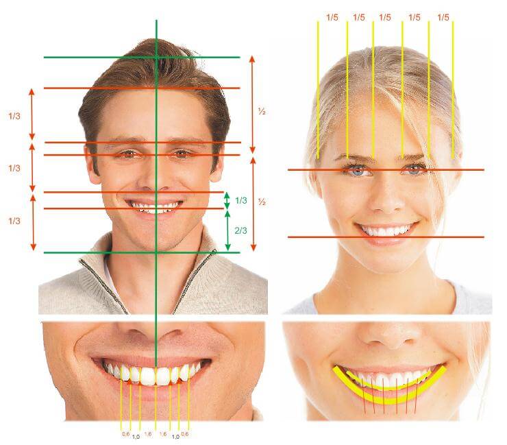 Smile Design - Dental Center Vietnam