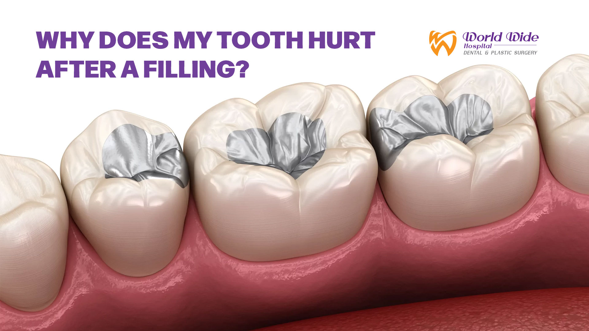 WHY DOES MY TOOTH HURT AFTER A FILLING? - Dental Center Vietnam