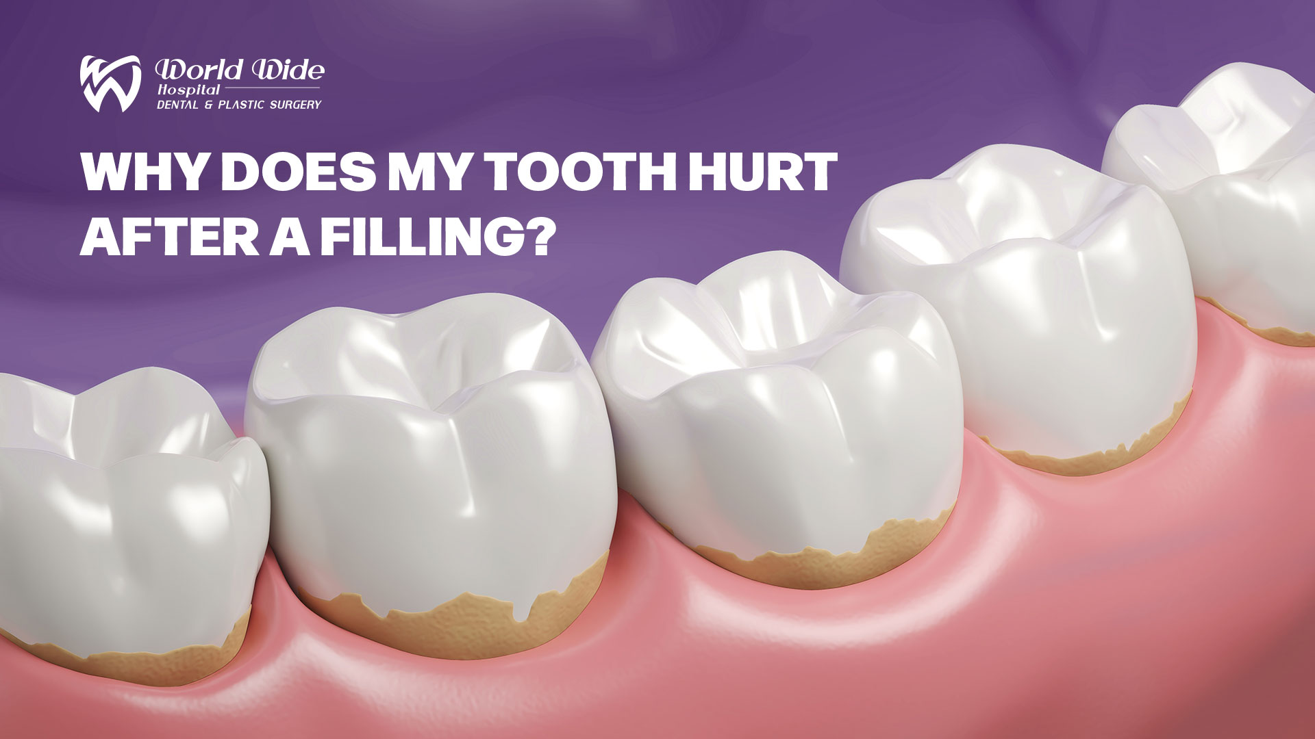 WHY IS REGULAR SCALING IMPORTANT FOR GUM HEALTH? - Dental Center Vietnam