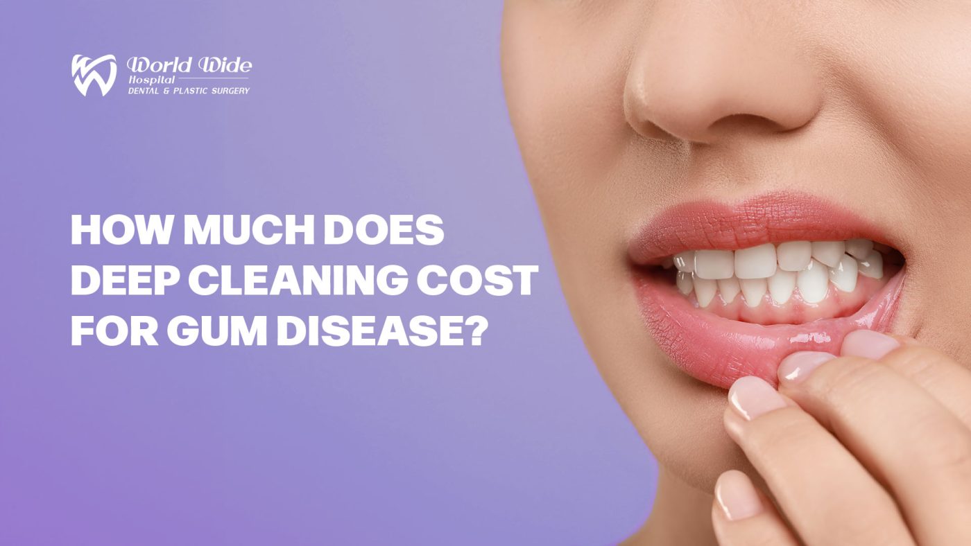 HOW MUCH DOES DEEP CLEANING COST FOR GUM DISEASE? - Dental Center Vietnam