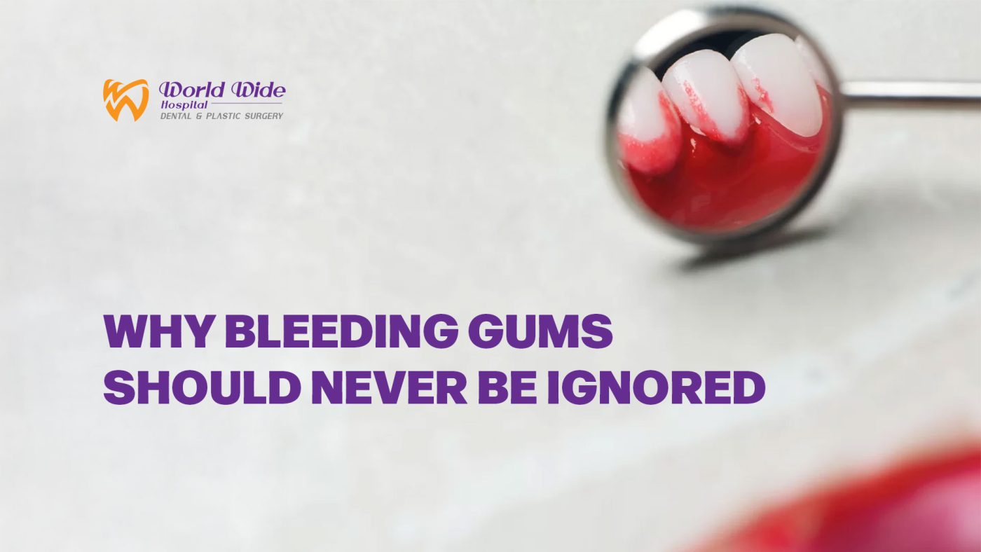 WHY BLEEDING GUMS SHOULD NEVER BE IGNORED - Dental Center Vietnam