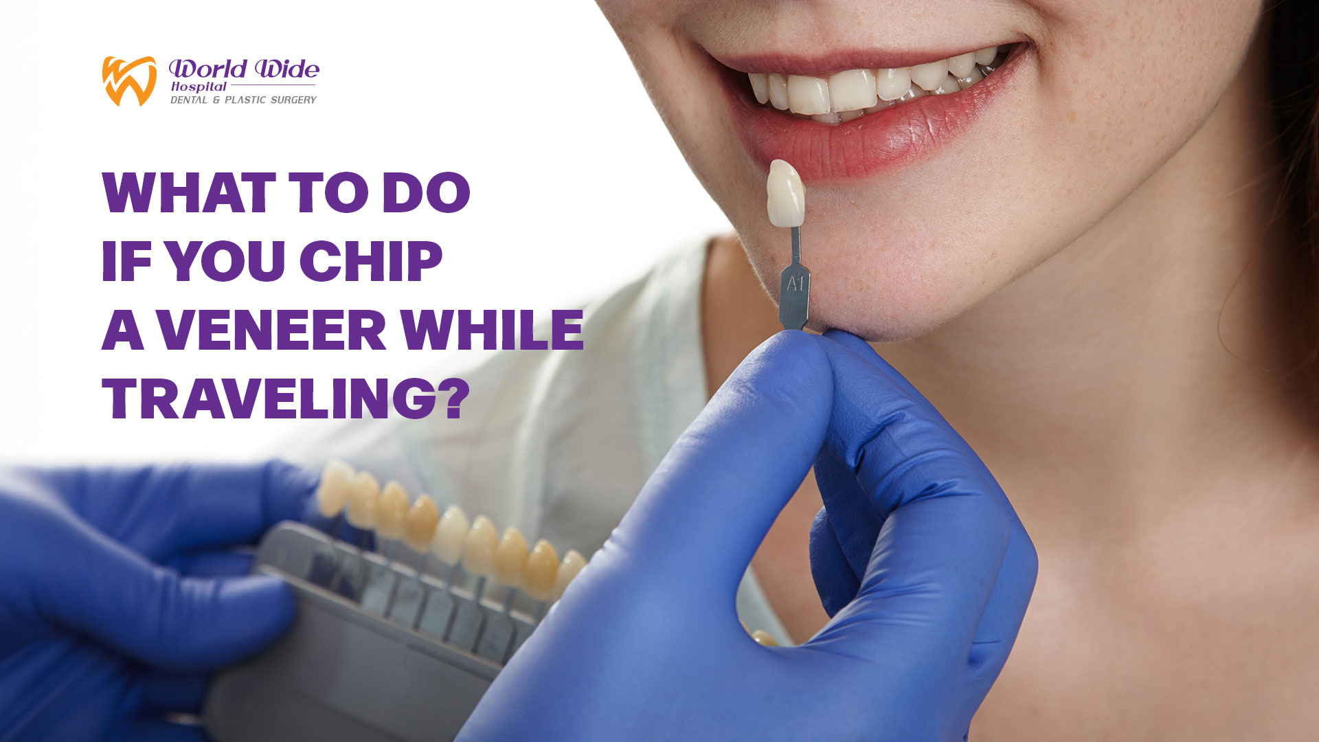 WHAT TO DO IF YOU CHIP A VENEER WHILE TRAVELING - Dental Center Vietnam